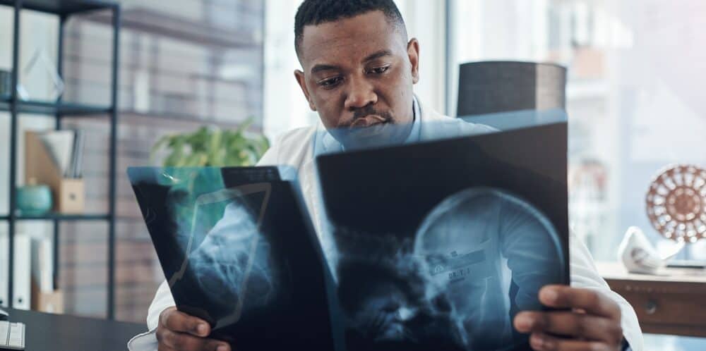 Head and Brain Injury Attorneys in PA | Scranton Personal Injury Law Firm